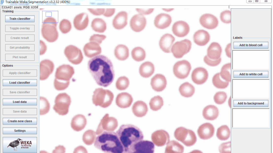 ImageJ实用技巧——基于机器学习的自动细胞分割(插件篇) - 知乎