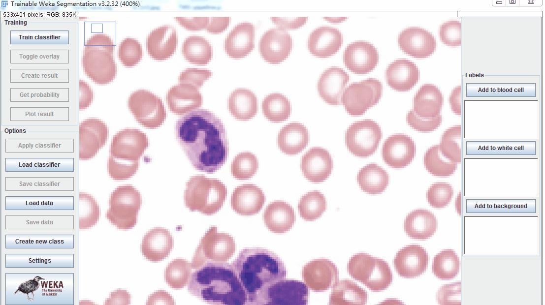 ImageJ实用技巧——基于机器学习的自动细胞分割(插件篇) - 知乎