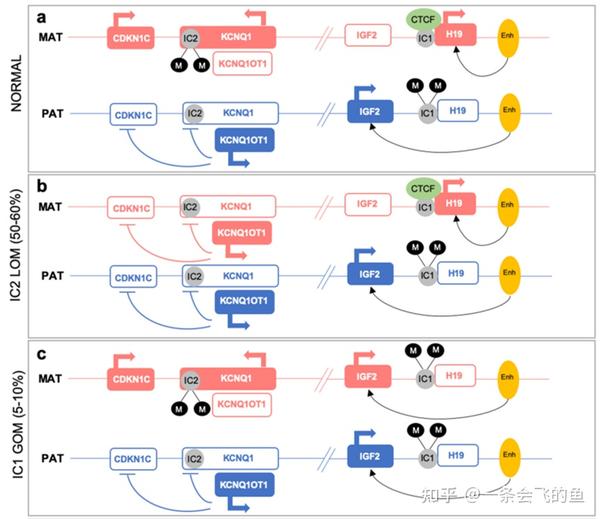 Beckwith-Wiedemann综合征-印记缺陷遗传病 - 知乎