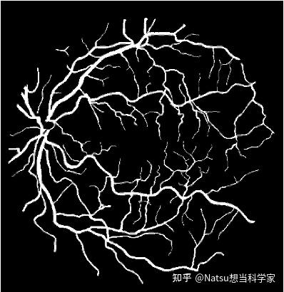 基于Unet的多类别分割(医疗影像方向-数据处理) - 知乎