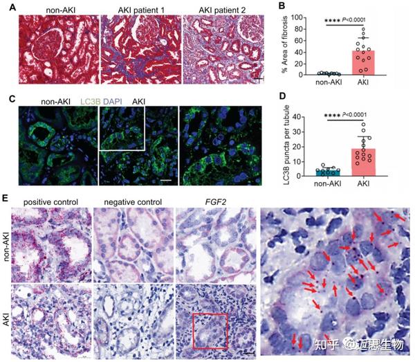 FGF2：纷繁复杂的调控因子 - 知乎