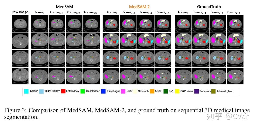 Medical SAM 2：基于SAM 2的2D/3D医学图像分割 - 知乎