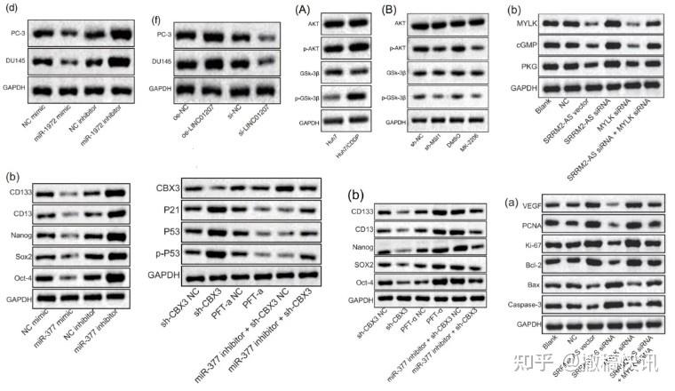 WB图可疑，流式图似手绘，中国医科大学附属第一医院的论文被撤稿 - 知乎