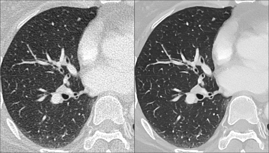 临床案例——RaDynMR、RaDynPET、RaDynCT、RaDynSPECT - 知乎