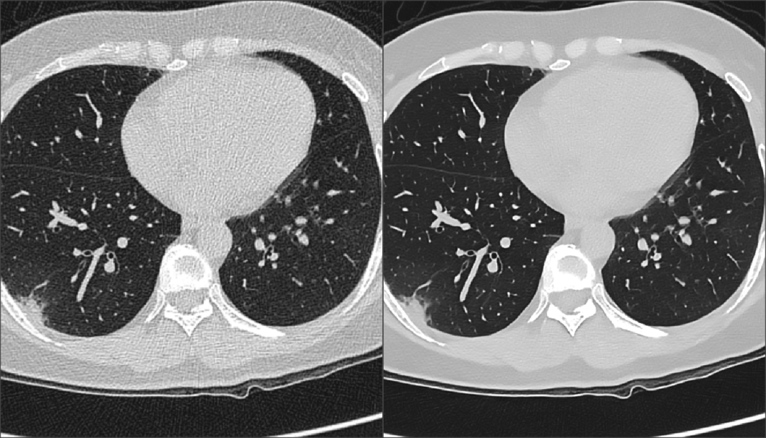 临床案例——RaDynMR、RaDynPET、RaDynCT、RaDynSPECT - 知乎