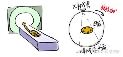 CT 想了解的都在这啦！全解析！ - 知乎