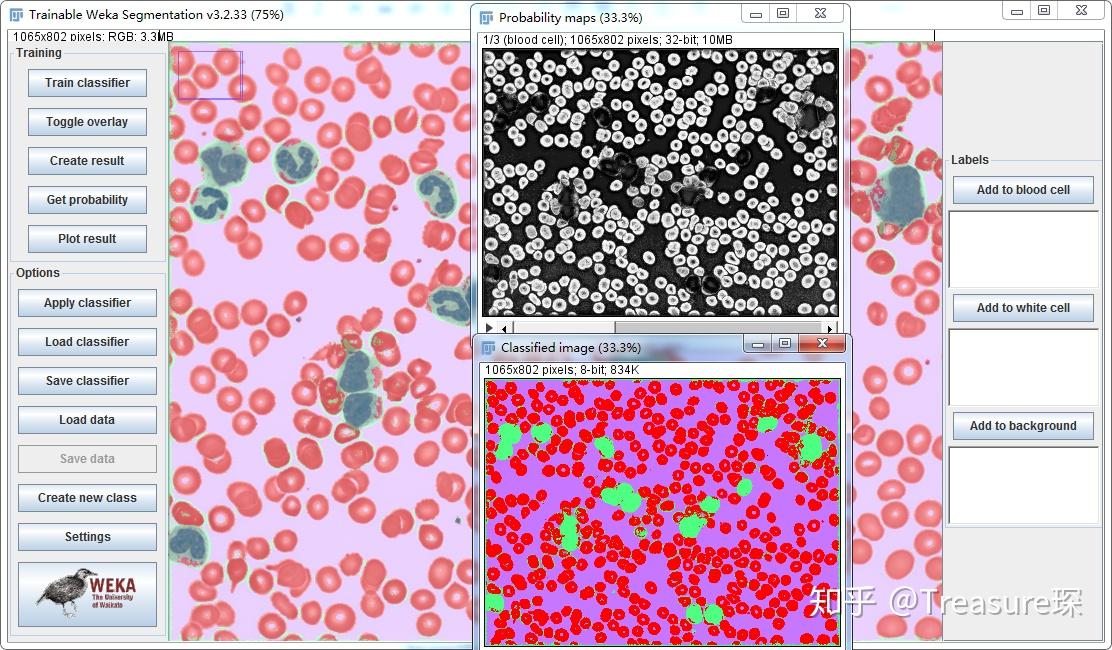 ImageJ实用技巧——基于机器学习的自动细胞分割(插件篇) - 知乎