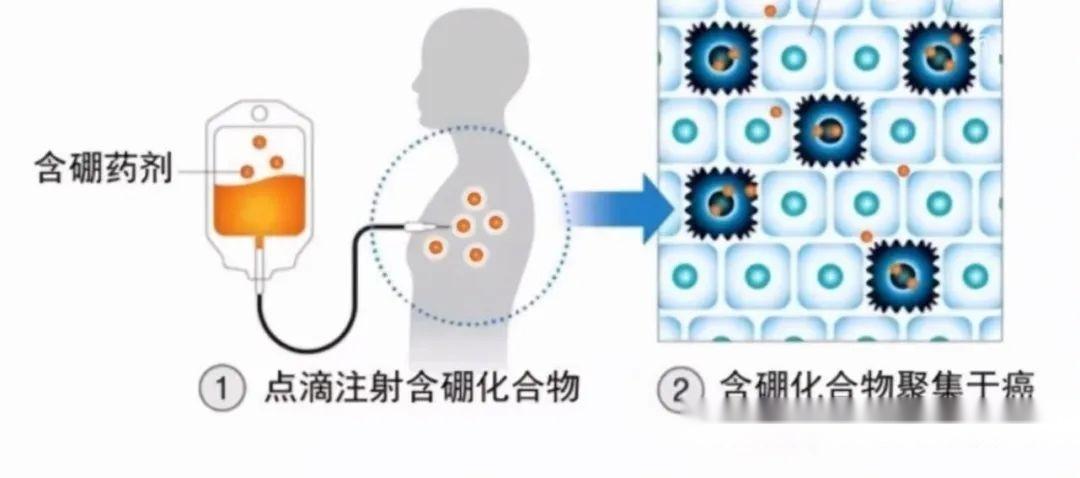 30分钟就能清零癌细胞？我国首个抗癌硼药即将上市，费用是多少？ - 知乎