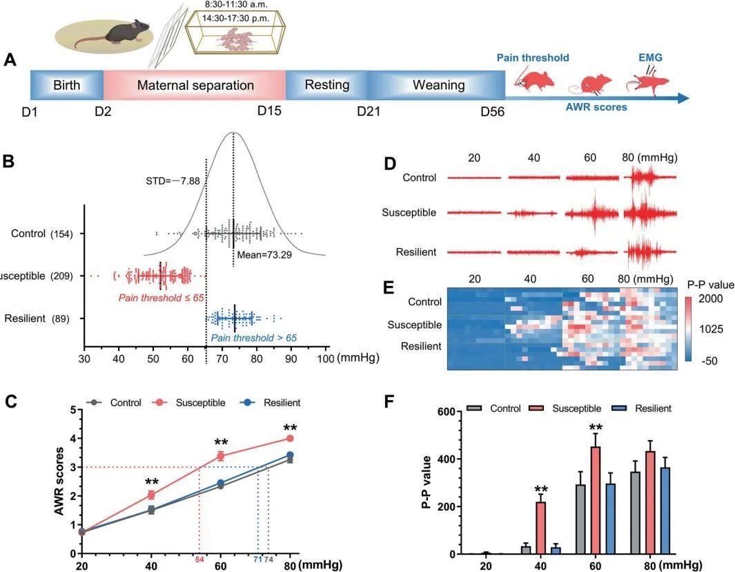 【客户文章】徐州医科大学张咏梅教授团队揭示avBNST-PVN神经环路介导生命早期应激致成年慢性内脏痛易感性的机制 - 知乎