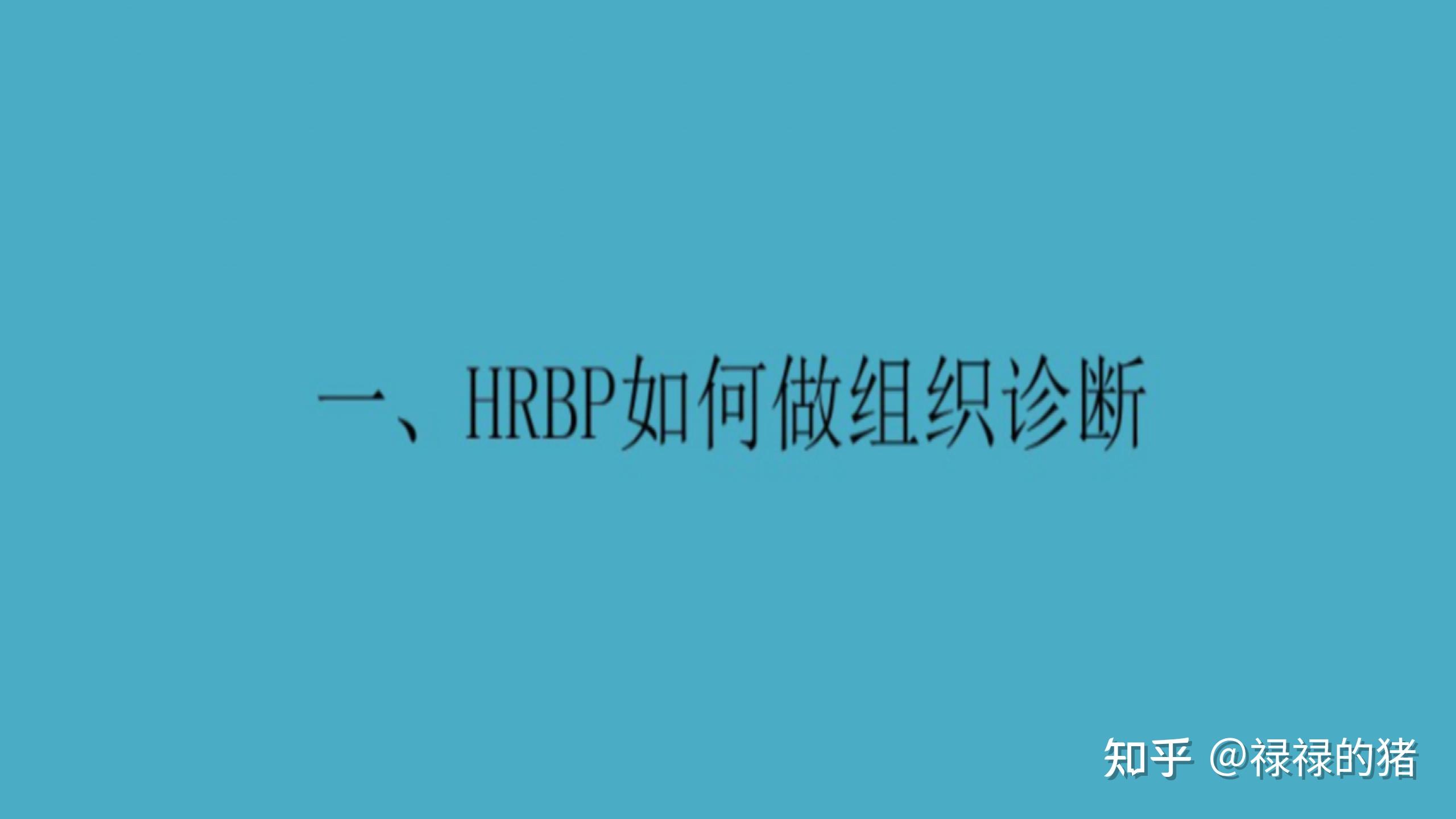 人力资源地图—HRBP关于OD、TD、LD的实操流程 - 知乎