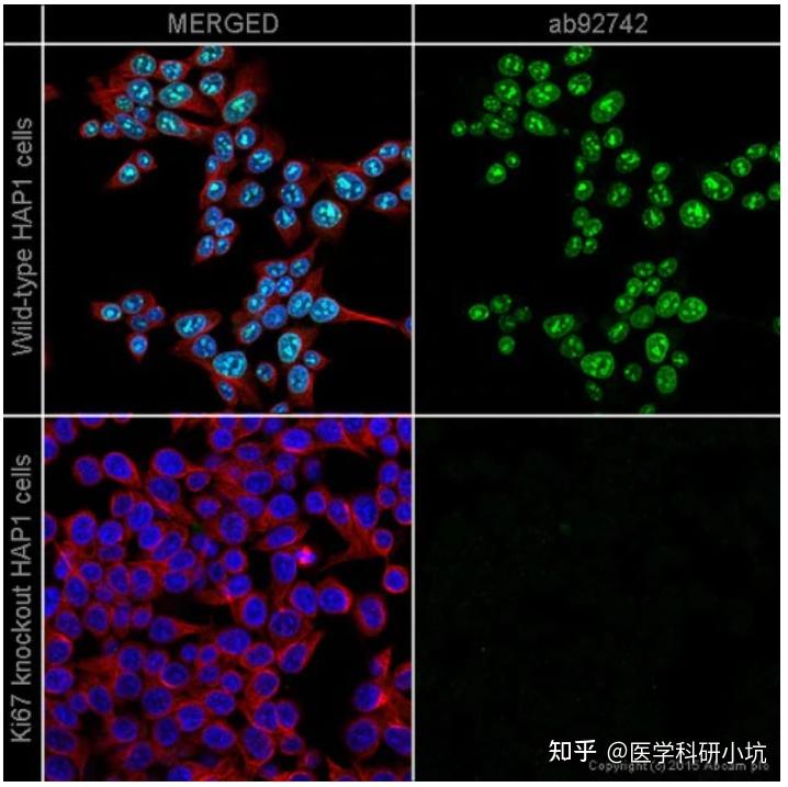 干货|免疫细胞化学（ICC）实验步骤及疑难问题 - 知乎