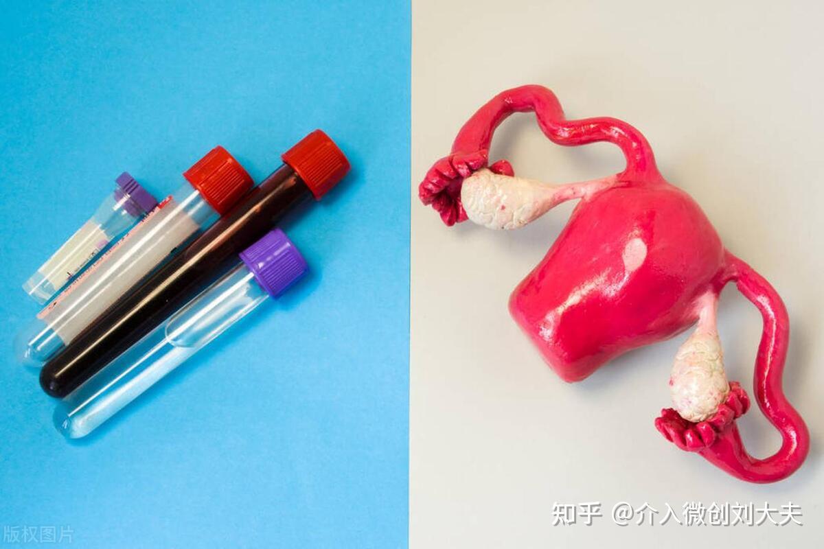 卵巢储备功能减退该如何治疗? 知乎