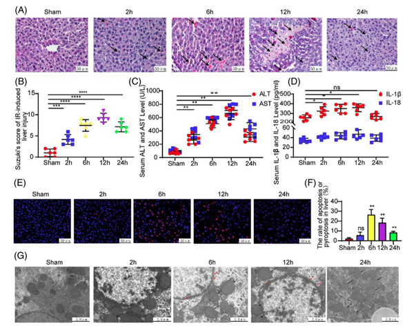 华西新刊丨MedComm丨NOD1诱导细胞焦亡加重小鼠肝脏缺血再灌注损伤 - 知乎