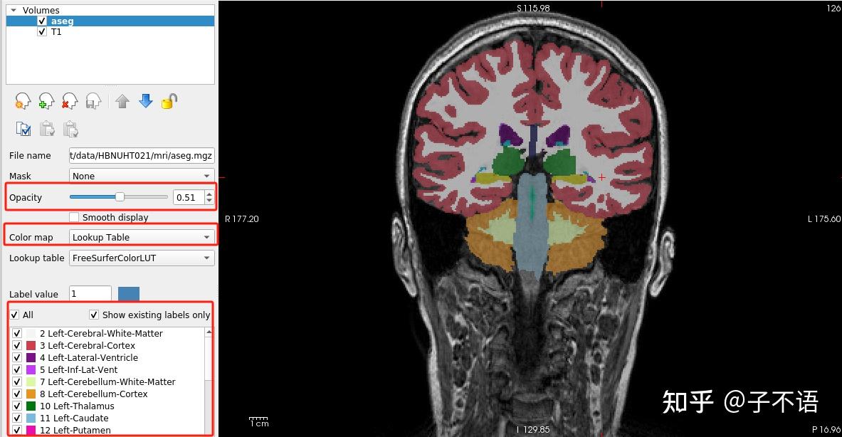 freesurfer全过程梳理 - 知乎