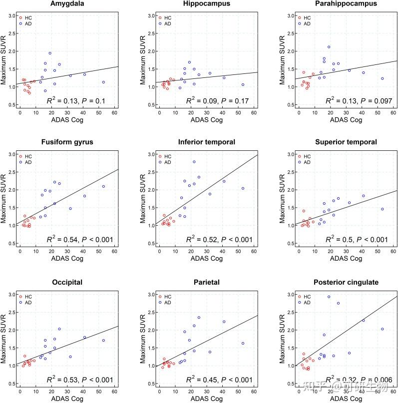 医学科研热点| 阿尔茨海默病tau PET影像诊断 - 知乎