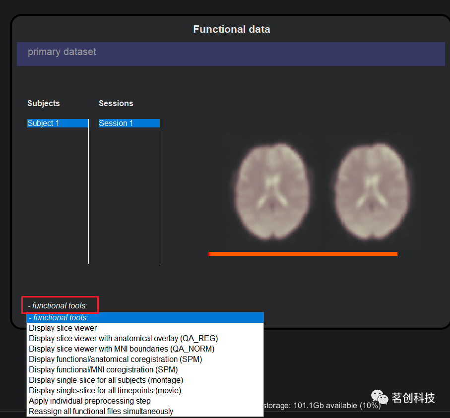 手把手教你使用CONN（预处理） - 知乎
