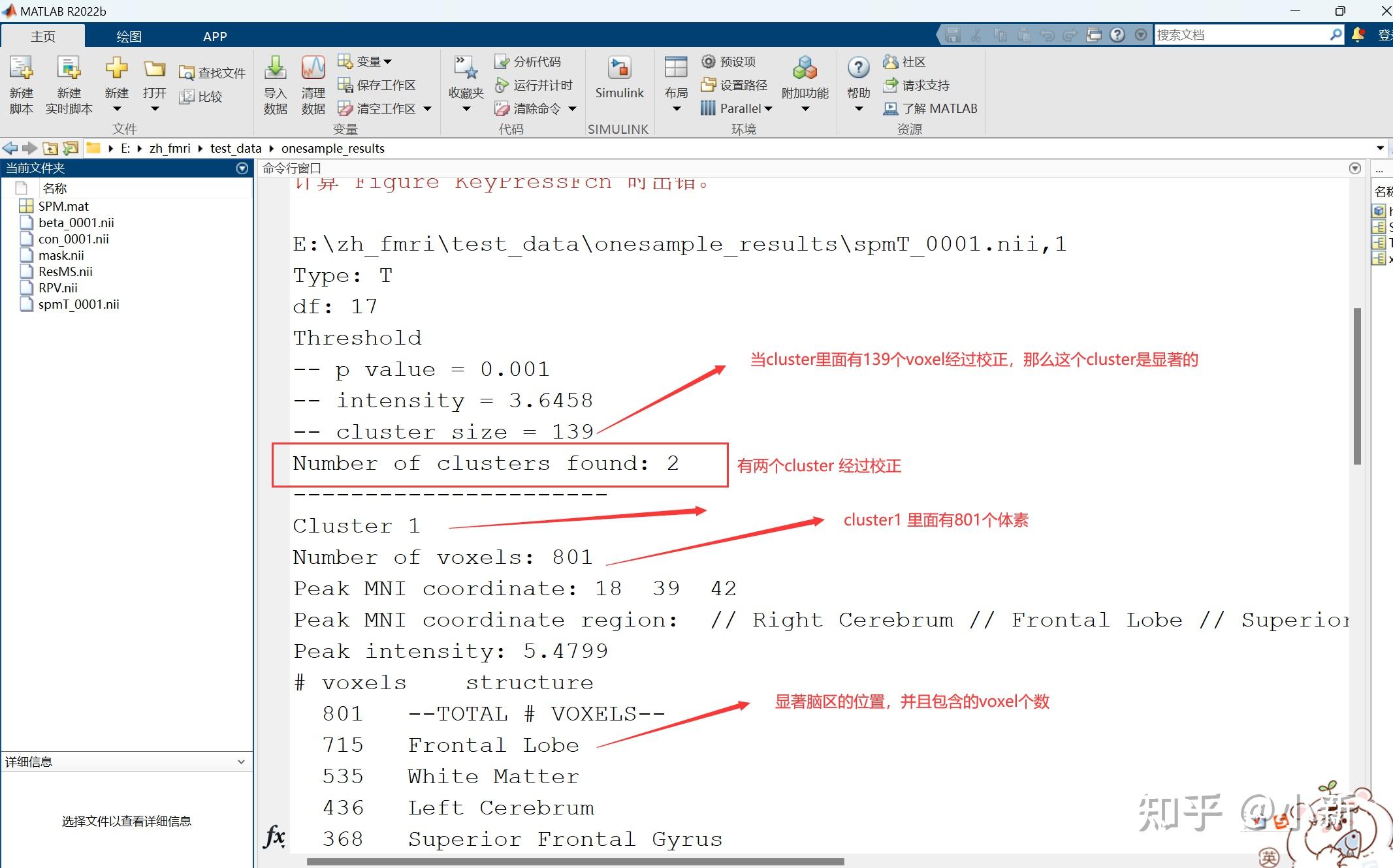 15（1）-SPM-fmri任务态 结果查看与汇报 xjview - 知乎