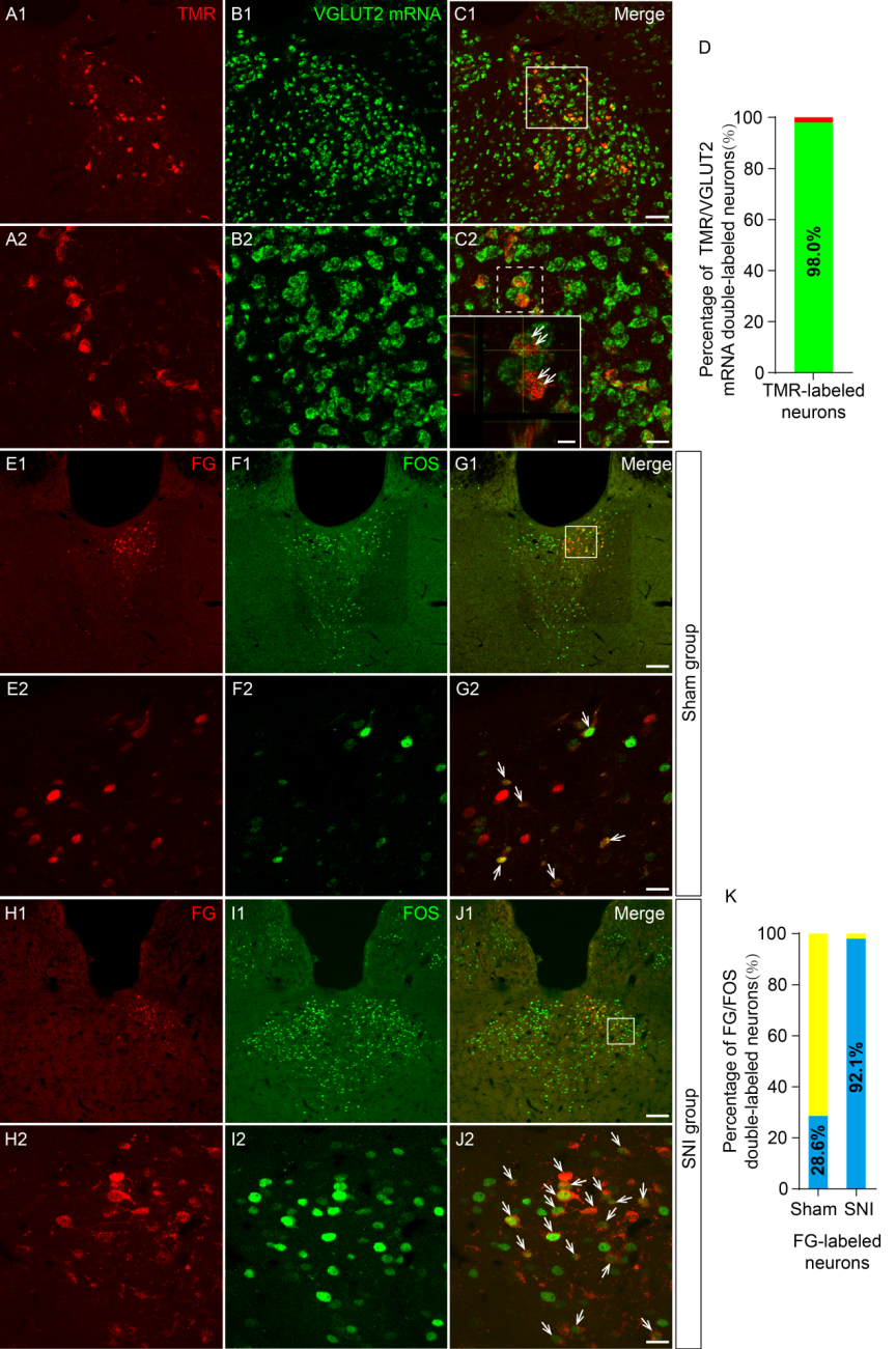 【客户文章】空军军医大学李云庆教授、董玉琳副教授团队在pPVT-CeA-vlPAG下行通路参与疼痛易化研究中取得新进展 - 知乎