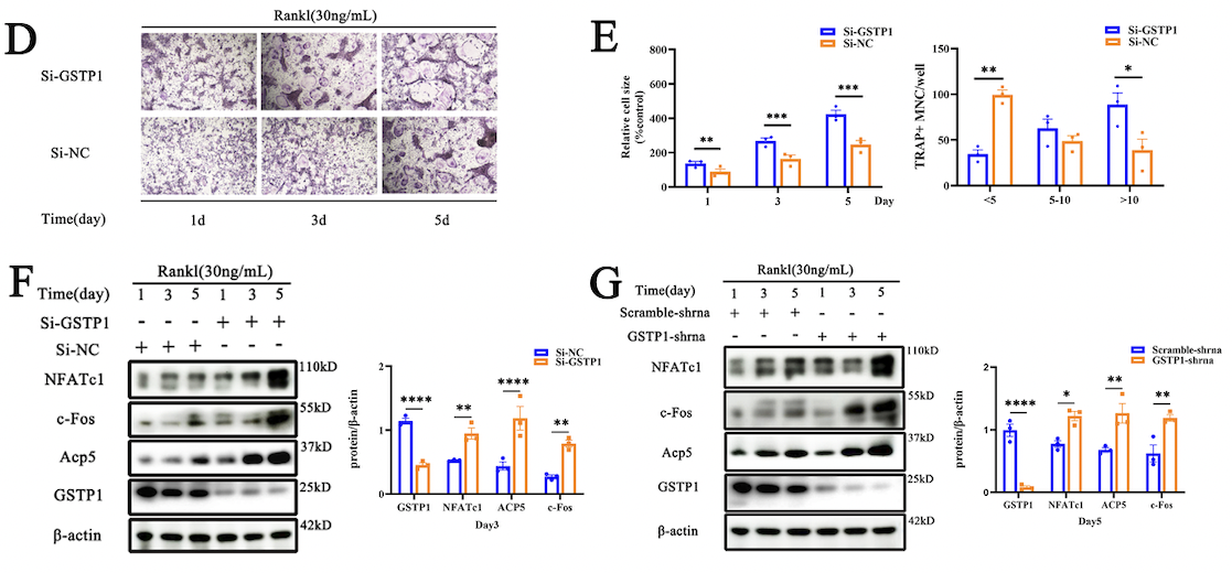 GSTP1介导的Pik3r1的S-谷胱甘肽化调控破骨细胞形成 - 知乎