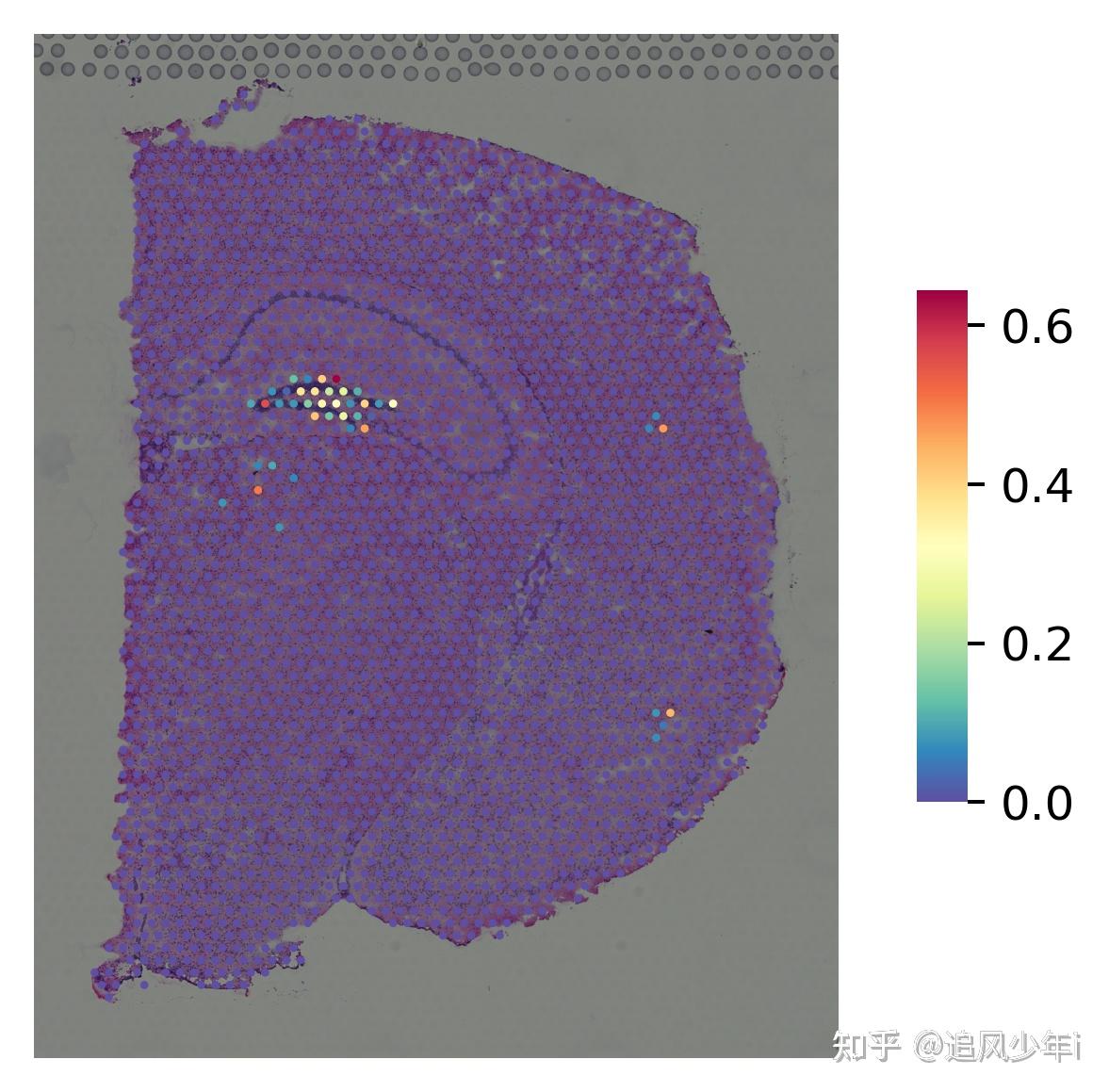 10X单细胞空间回顾之stlearn - 知乎