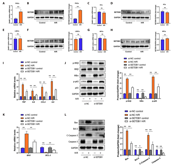 国产顶刊Research丨肝细胞 SETDB1 通过靶向 ASK1 信号的赖氨酸甲基化调控肝缺血再灌注损伤 - 知乎