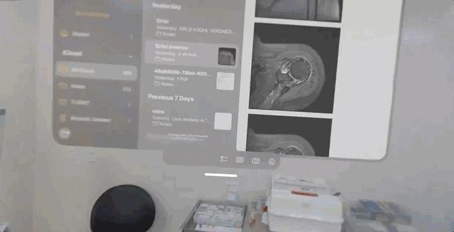 巴西医生使用 Apple Vision Pro辅助手术 - 知乎