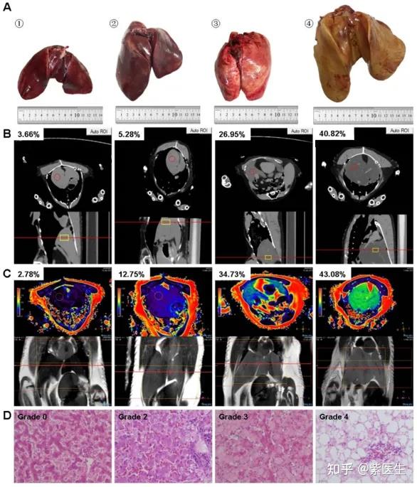 定量CT（QCT）是什么？临床应用有哪些？ - 知乎