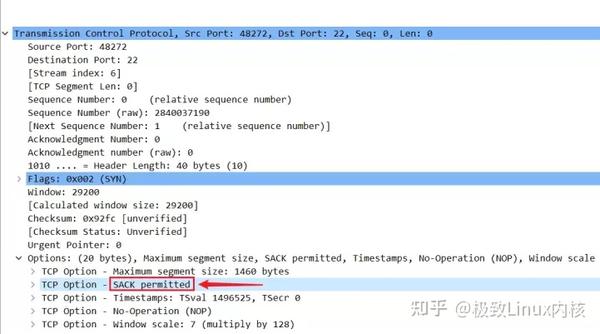 详细的Linux TCP内核参数设置与调优！！！ - 知乎