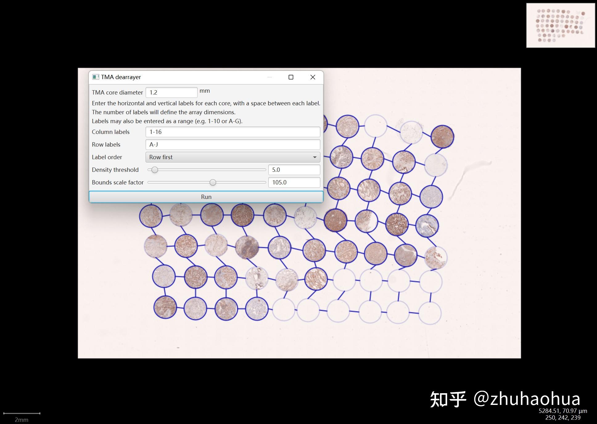 【笔记】QuPath用于免疫组化定量评估 - 知乎