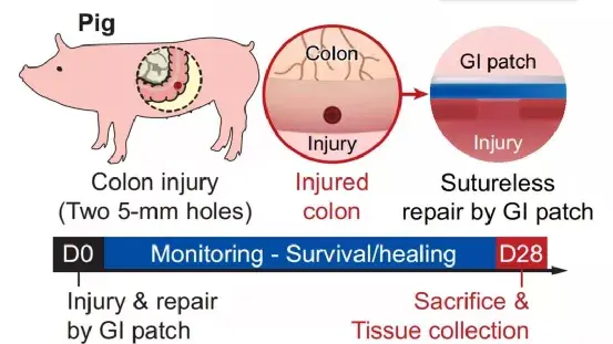 《Science子刊》麻省理工学院赵选贺：新型水凝胶贴片胶带，即拆即用无缝修复胃肠道缺陷！ - 知乎