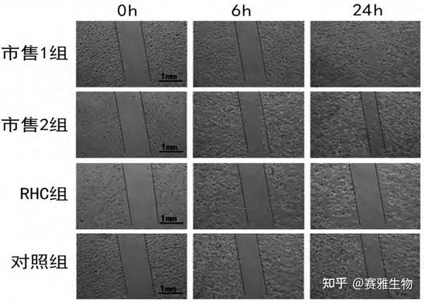 重组胶原蛋白（RHC）：表皮修护新选择，你了解它的作用机理吗？ - 知乎