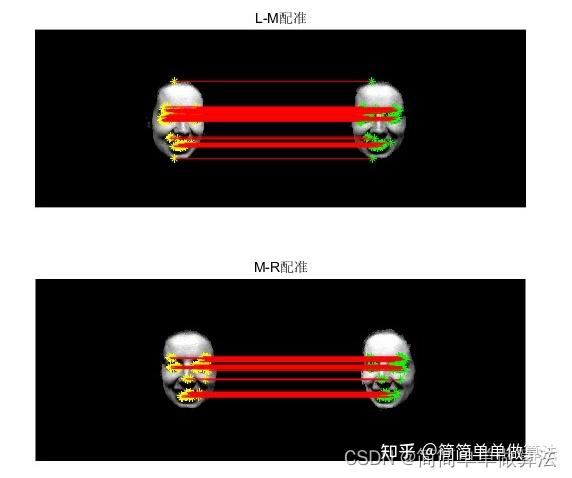 基于双目人脸图像ORB特征提取匹配的人脸三维点云提取和建模的matlab仿真 - 知乎