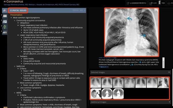 手把手教程：美国医生广泛好评的影像学工具STATdx用户指南 - 知乎