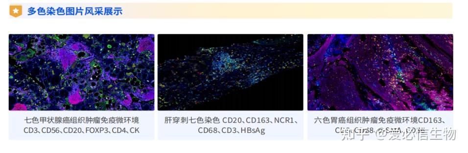CD44与CD62L对肿瘤细胞和T细胞的标记意义 - 知乎