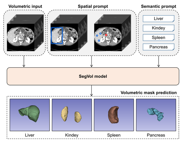 SegVol：通用可交互的医学体素分割模型（已开源） - 知乎