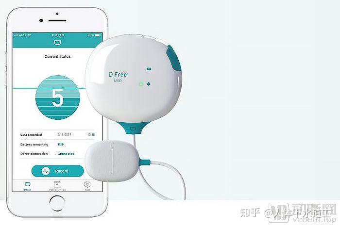 AI带来神经源性膀胱患者福音-可穿戴膀胱检测 - 知乎