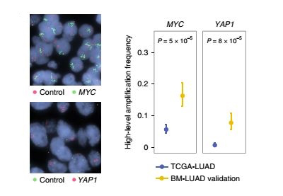 MYC、YAP1和MMP13基因扩增驱动肺癌脑转移 - 知乎