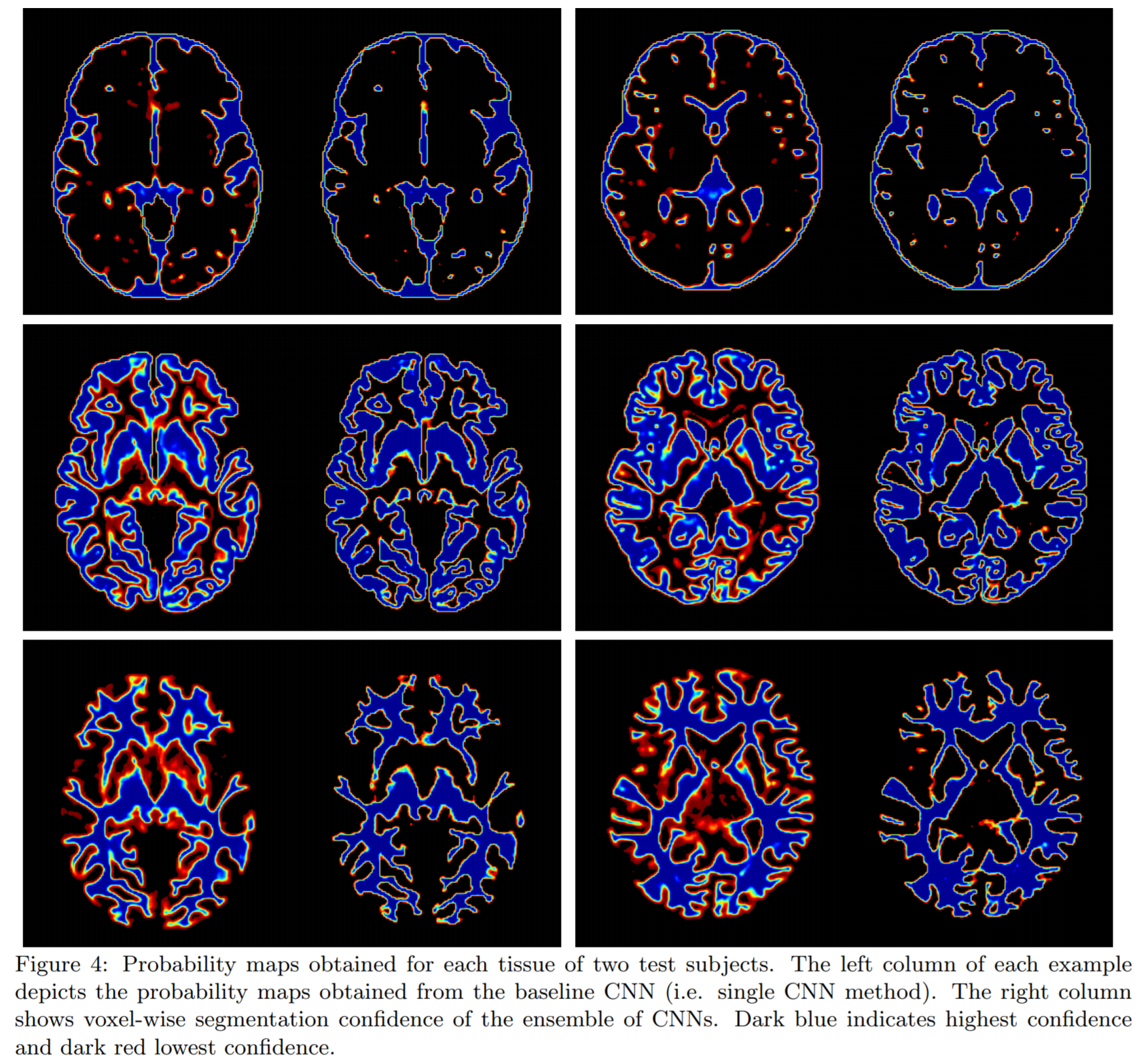 【论文速递1-7】医学影像分割方向优质的论文及其代码 - 知乎