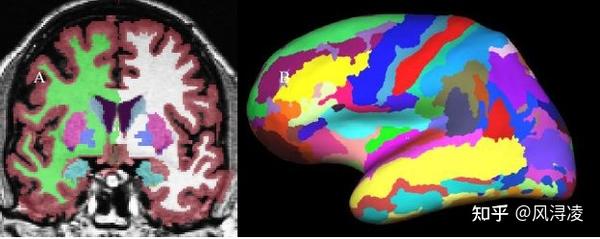 freesurfer下载安装，常用术语和recon-all命令 - 知乎