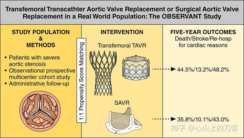 主动脉瓣狭窄的治疗，TAVR和SAVR，应该怎么选？ - 知乎