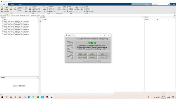 如何用SPM完成fMRI数据的预处理【任务态】 - 知乎