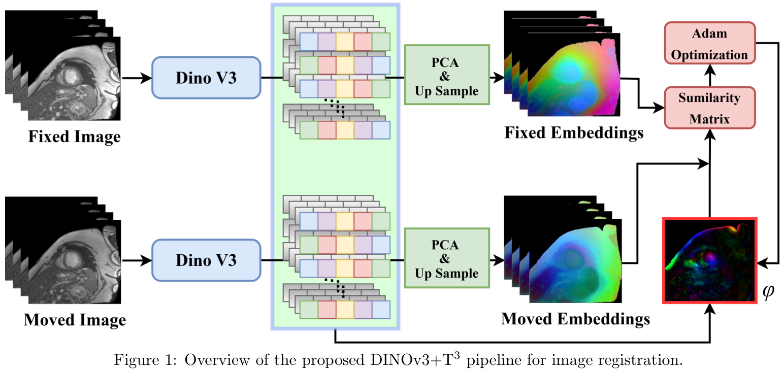 强大DINOv3实战来了，无需训练，DINOv3与测试时优化引领医学图像配准新范式 - 知乎