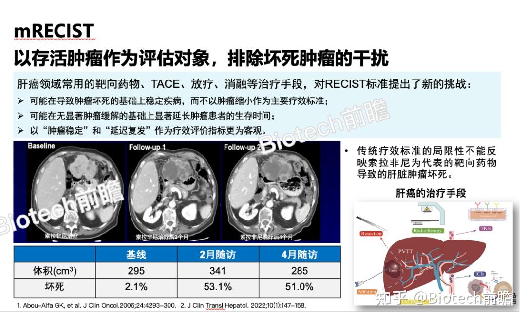 试验设计课堂丨读懂实体瘤疗效（RECIST1.1、mRECIST等）评估 - 知乎