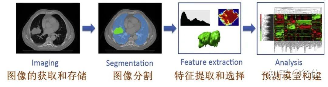 影像组学—pyradiomics技术流程 - 知乎