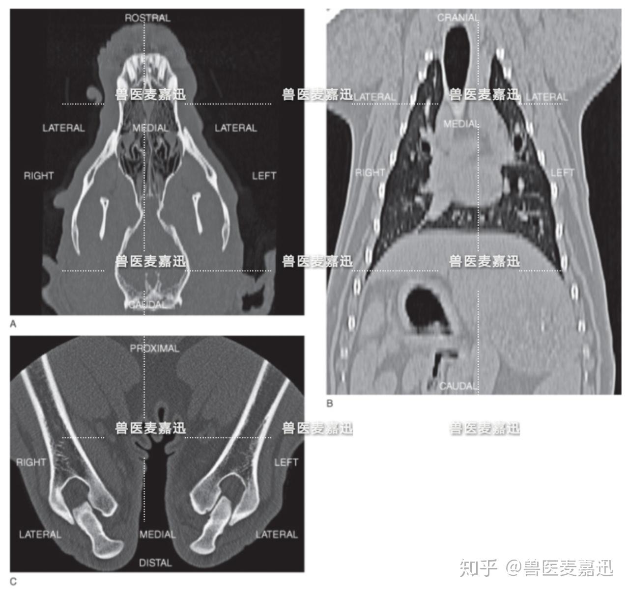 CT基础篇—方位术语与扫描平面 - 知乎