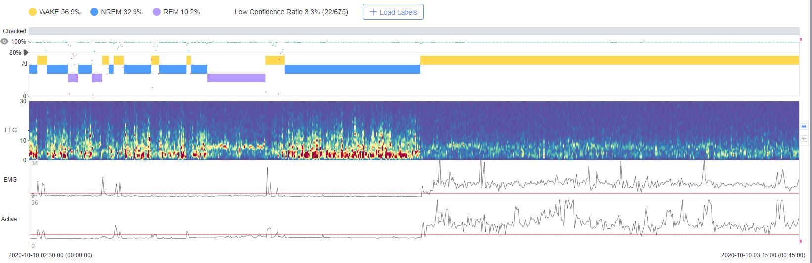 【Lunion Stage】如何使用频谱图提高睡眠分析效率 - 知乎