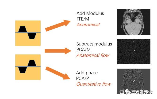 大脑静脉解剖及MR扫描技术原理 - 知乎