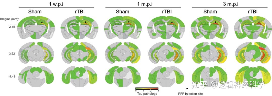 Sci Transl Med︱突破！改善阿兹尔海默病的新方向：微管的适度稳定 - 知乎