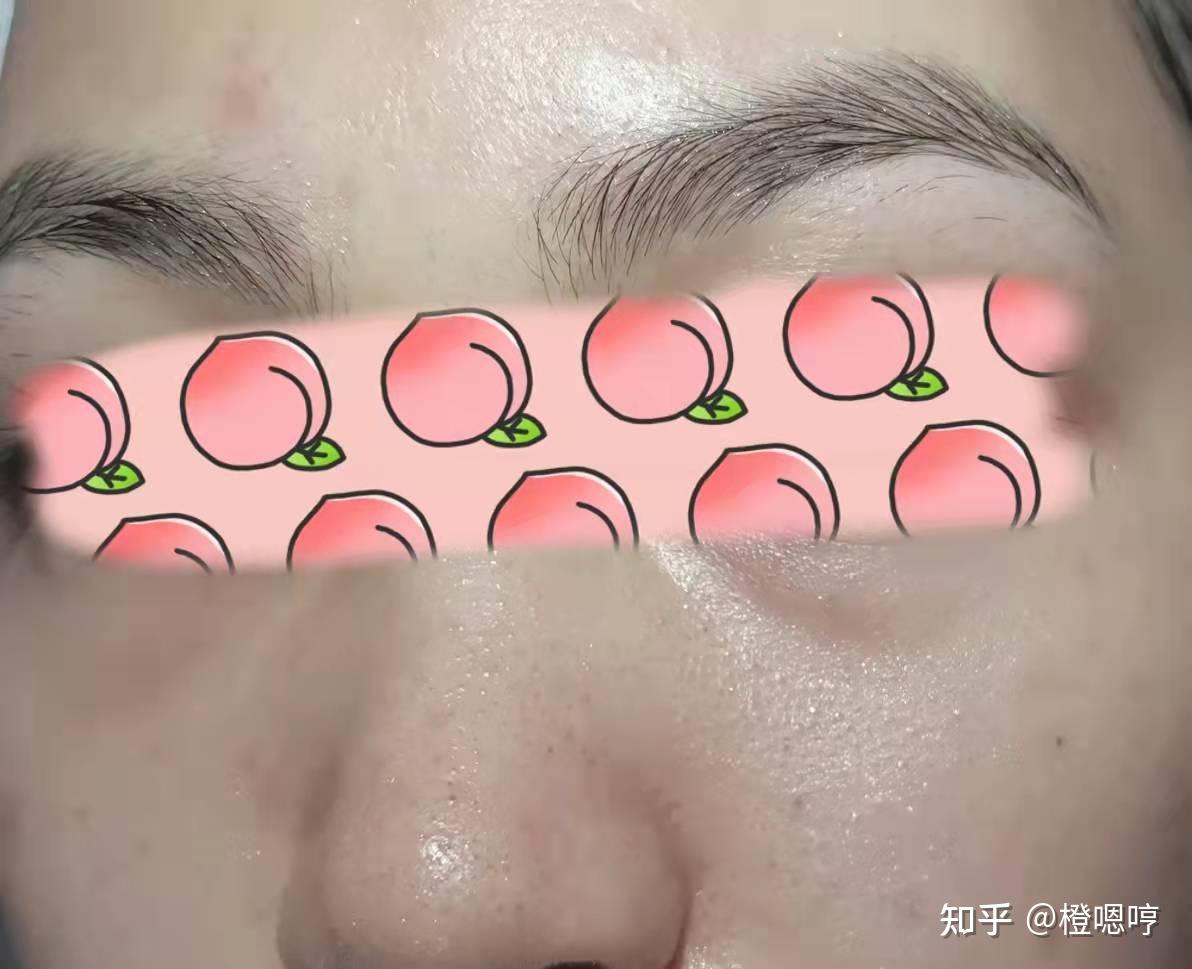 有什么可以让皮肤变好的小习惯? 知乎