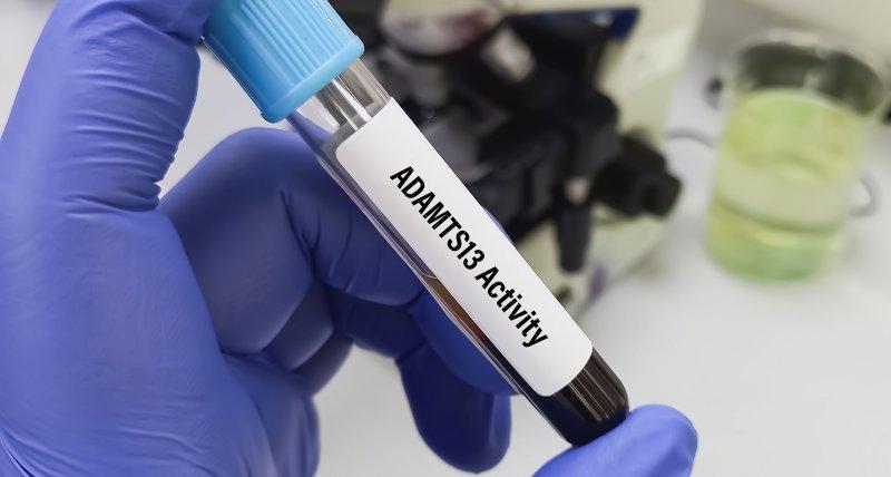 武田酶替代疗法ADZYNMA在欧盟获批用于治疗罕见凝血障碍疾病 - 知乎